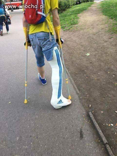 Sebiks i jego gips - wiocha.pl absurd 1440884